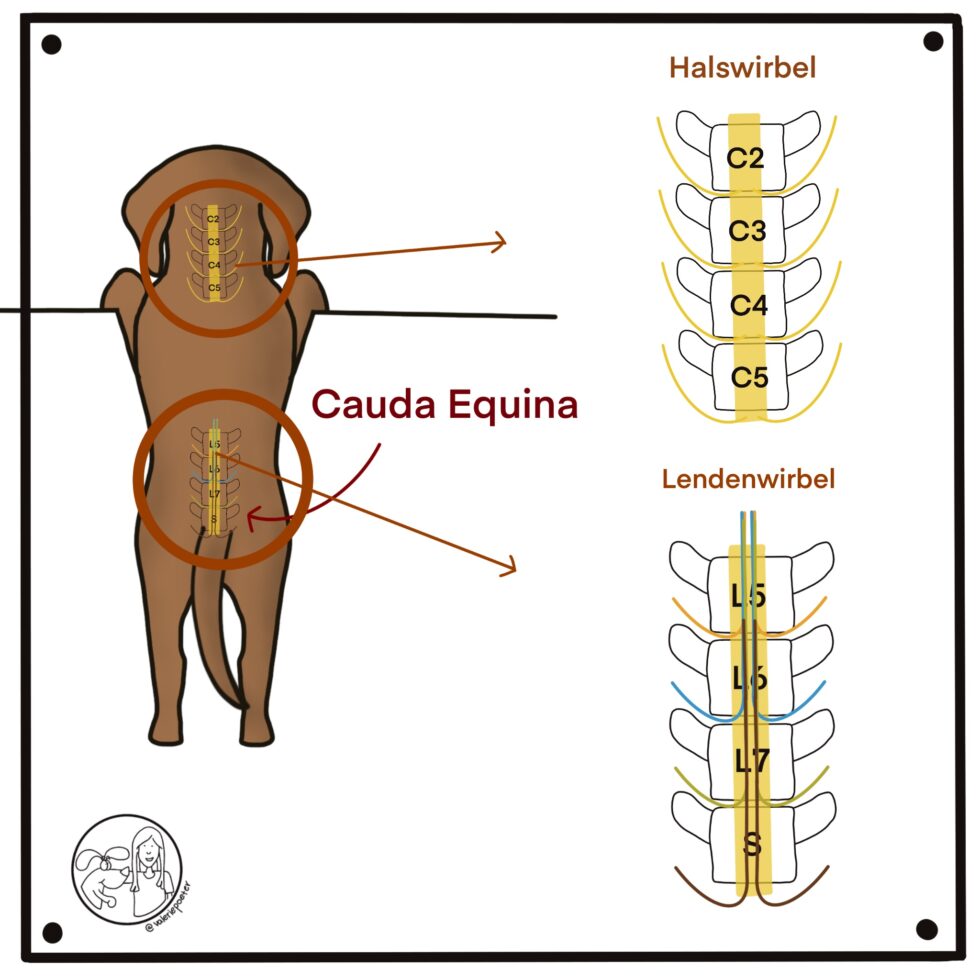 Das Cauda Equina Syndrom auf den Punkt gebracht!