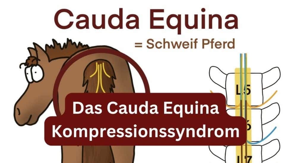 Das Cauda Equina Syndrom auf den Punkt gebracht!